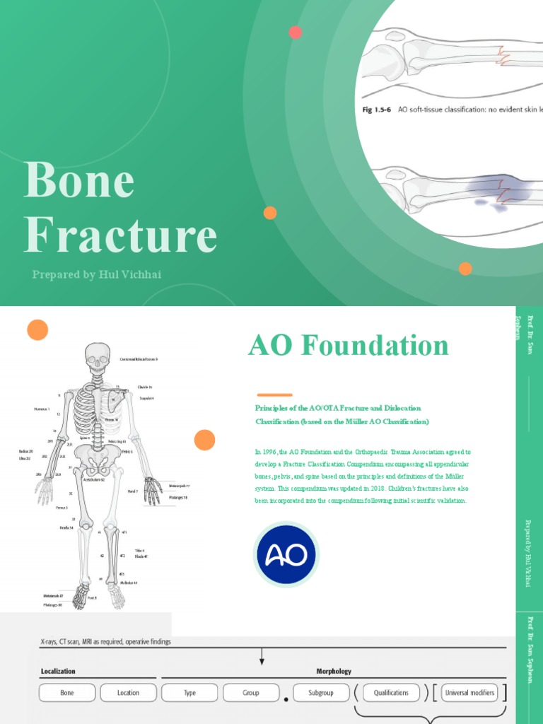 Fracture | PDF