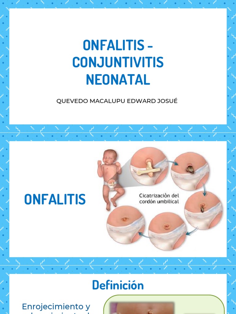 Onfalitis - Conjuntivitis Neonatal | PDF | Herpes Simple | Epidemiología