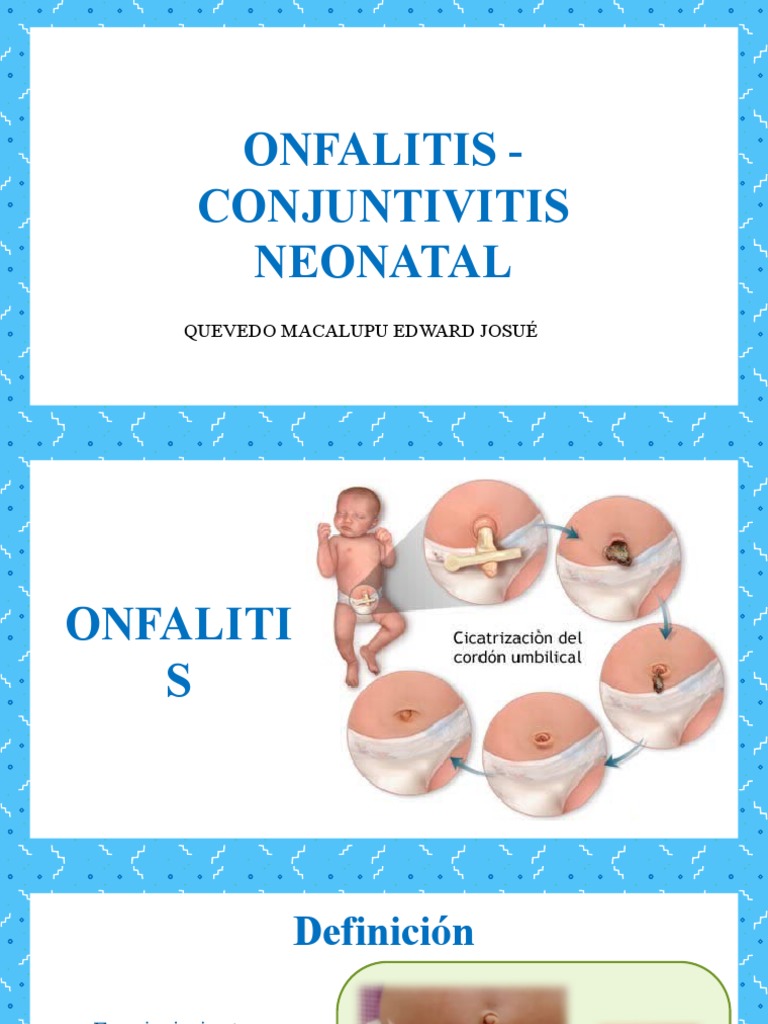 Onfalitis - Conjuntivitis Neonatal | PDF | Especialidades Medicas ...