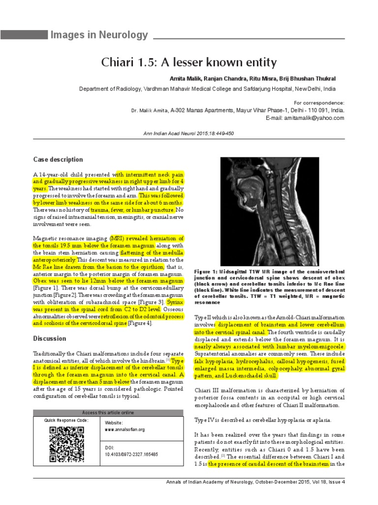 Chiari 1,5 | PDF | Diseases And Disorders | Human Diseases And Disorders