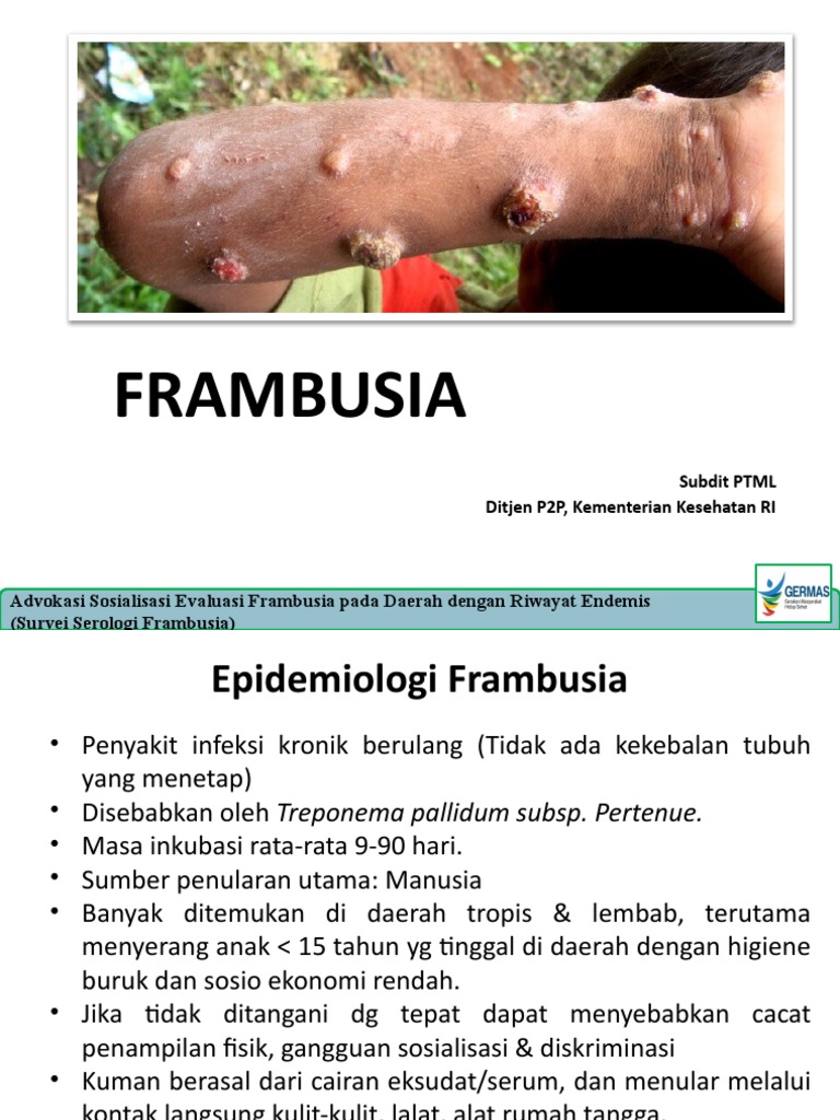 Penyakit Frambusia | PDF