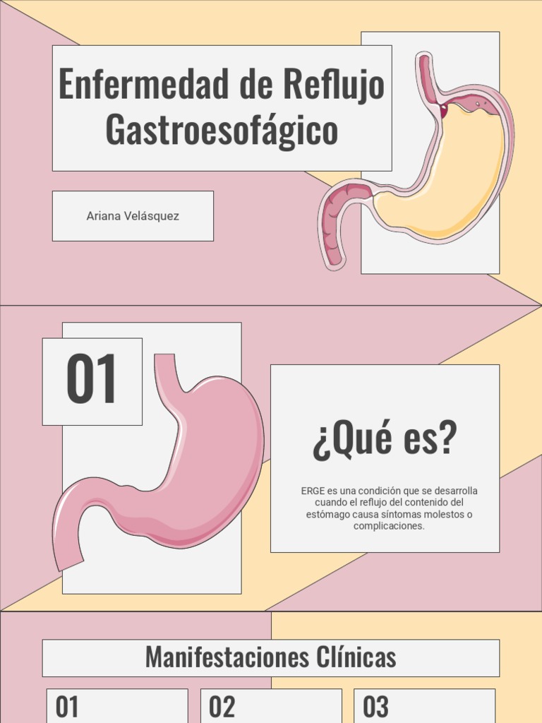 ERGE | PDF | La enfermedad por reflujo gastroesofágico | Medicina CLINICA