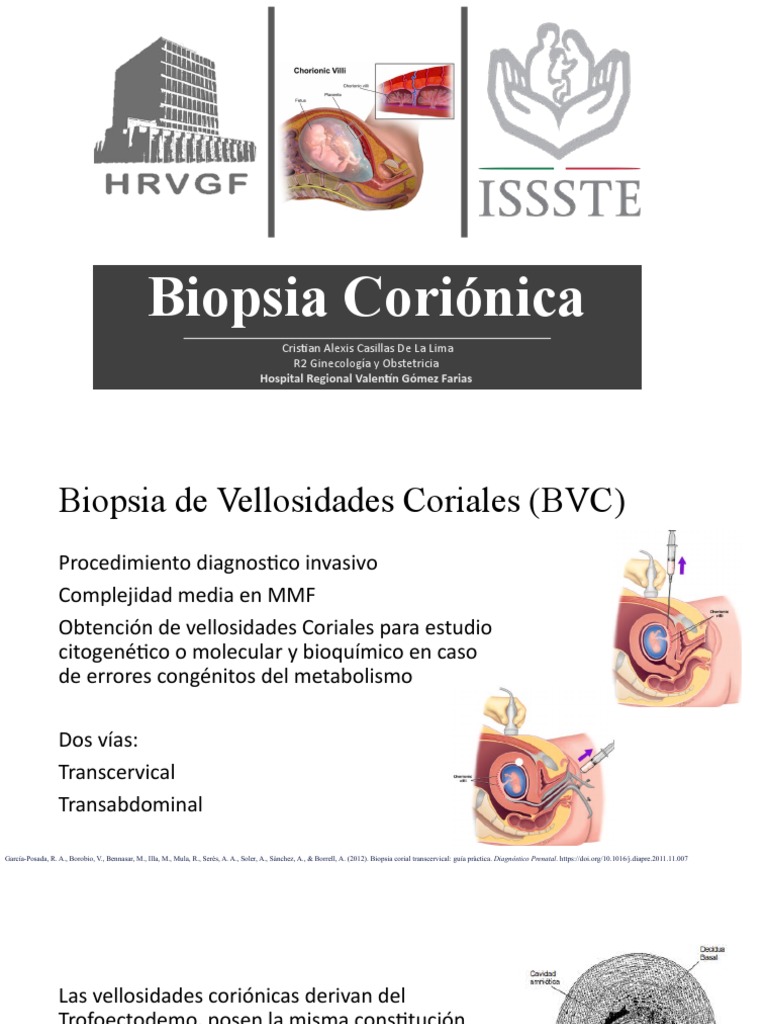 Biopsia Coriónica: Hospital Regional Valentín Gómez Farias | PDF ...
