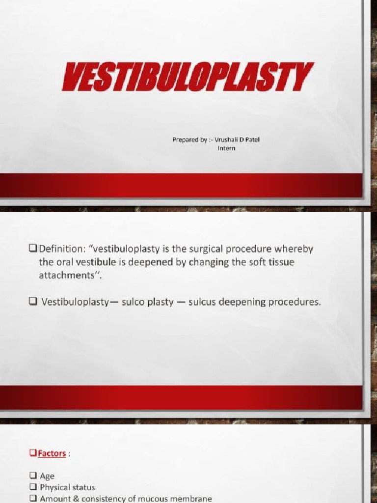 Vestibuloplasty | PDF