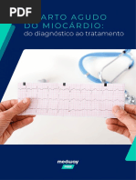 Classificacao de Killip | PDF