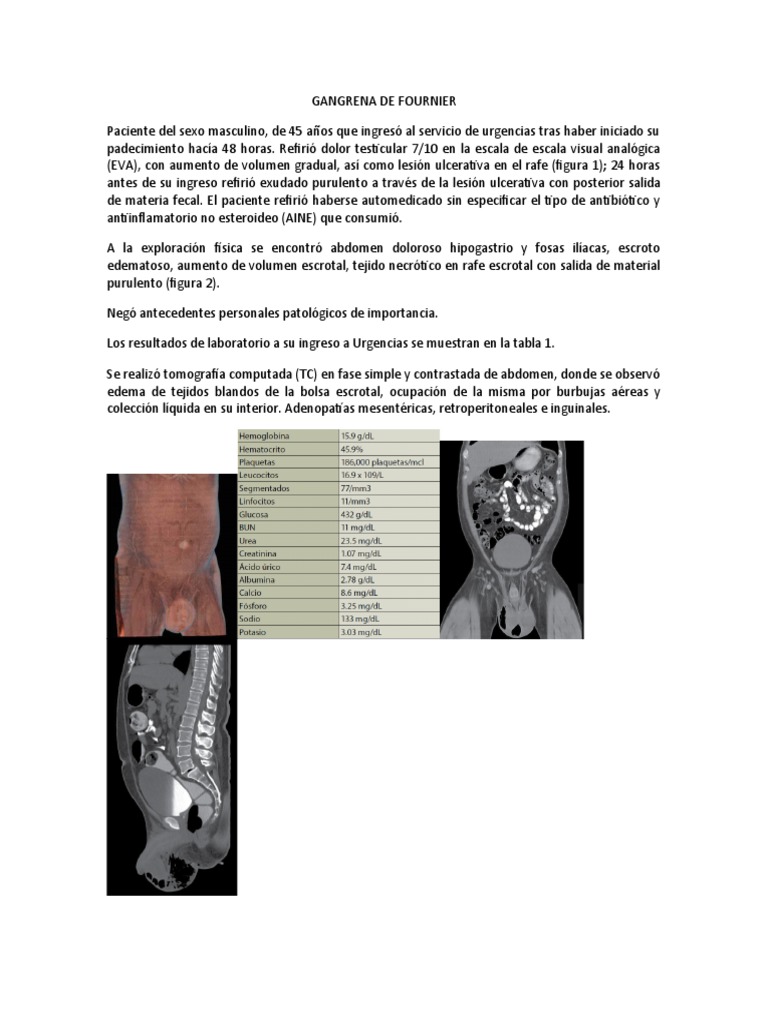 Gangrena de Fournier: Caso Clínico y Tratamiento | PDF