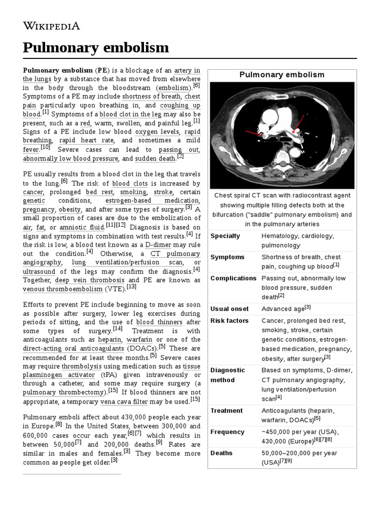 Pulmonary Embolism | PDF | Clinical Medicine | Medical Specialties