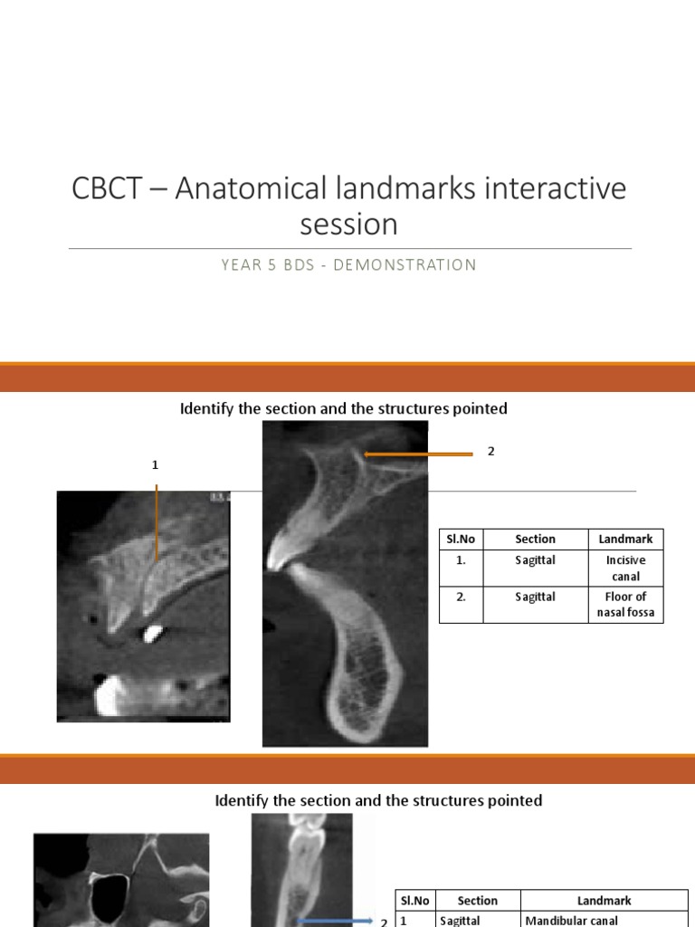 CBCT Assignment - Anatomical Landmarks 161323041 1 | PDF