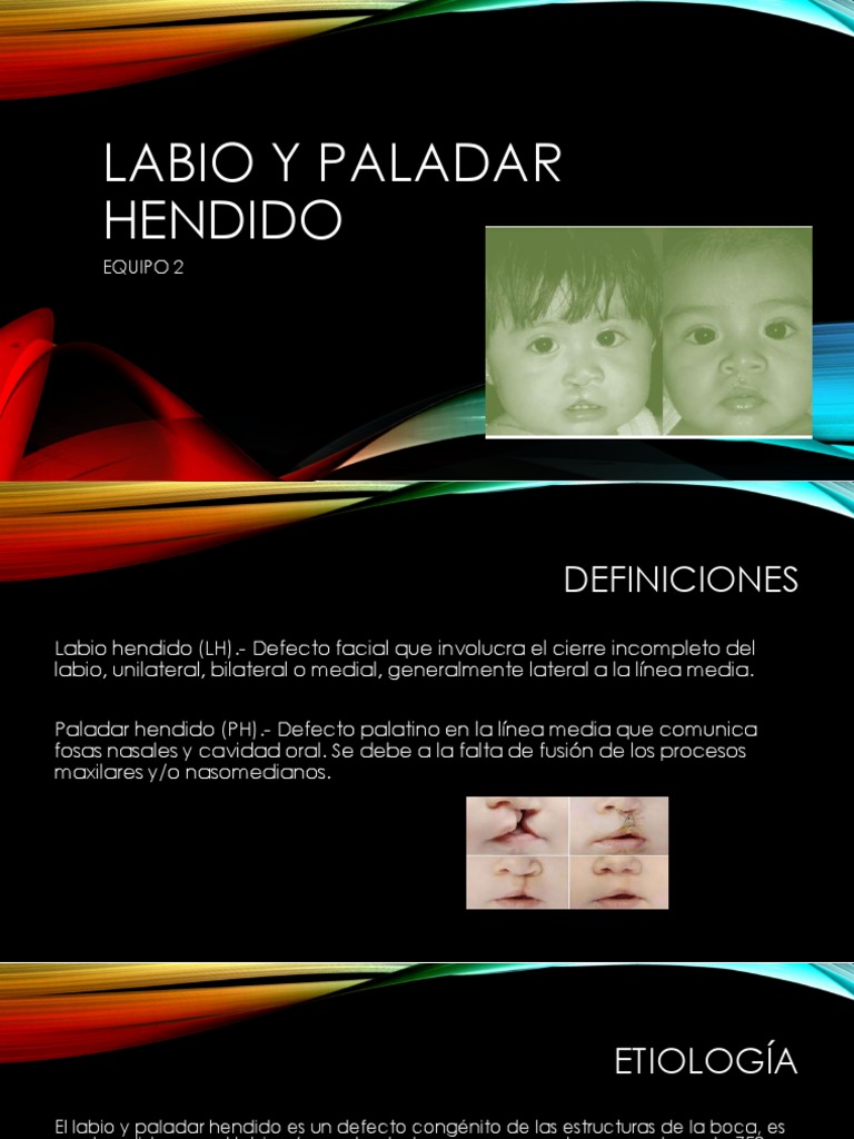 Labio y Paladar Hendido | PDF | Medicina | Medicina CLINICA