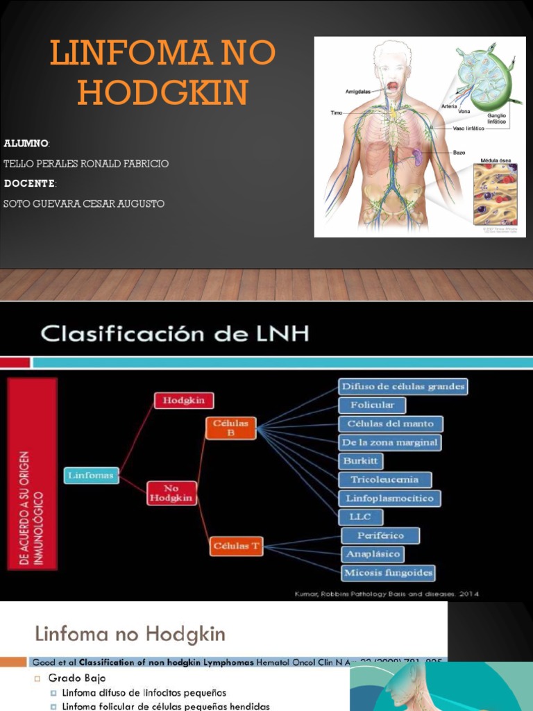 Linfoma No Hodgkin | PDF