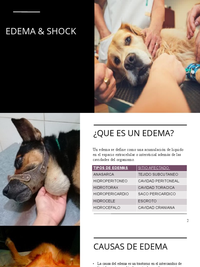 Edema y Shock | PDF