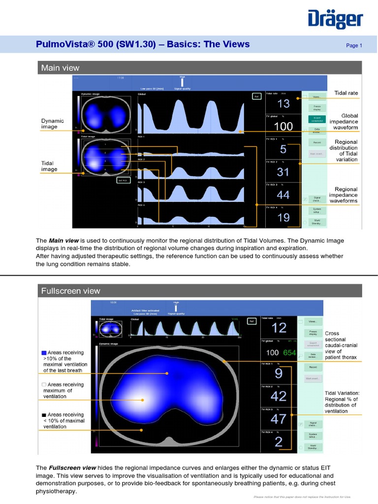 PulmoVista 500 SW1.30 - Basics - THE VIEWS | PDF