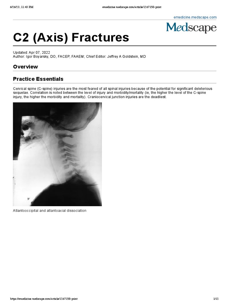 C2 (Axis) Fractures | PDF | Vertebra | Clinical Medicine