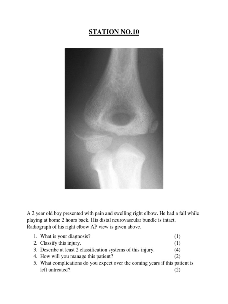 Milch Classification of Distal Humerus Fracture | PDF | Sports & Recreation