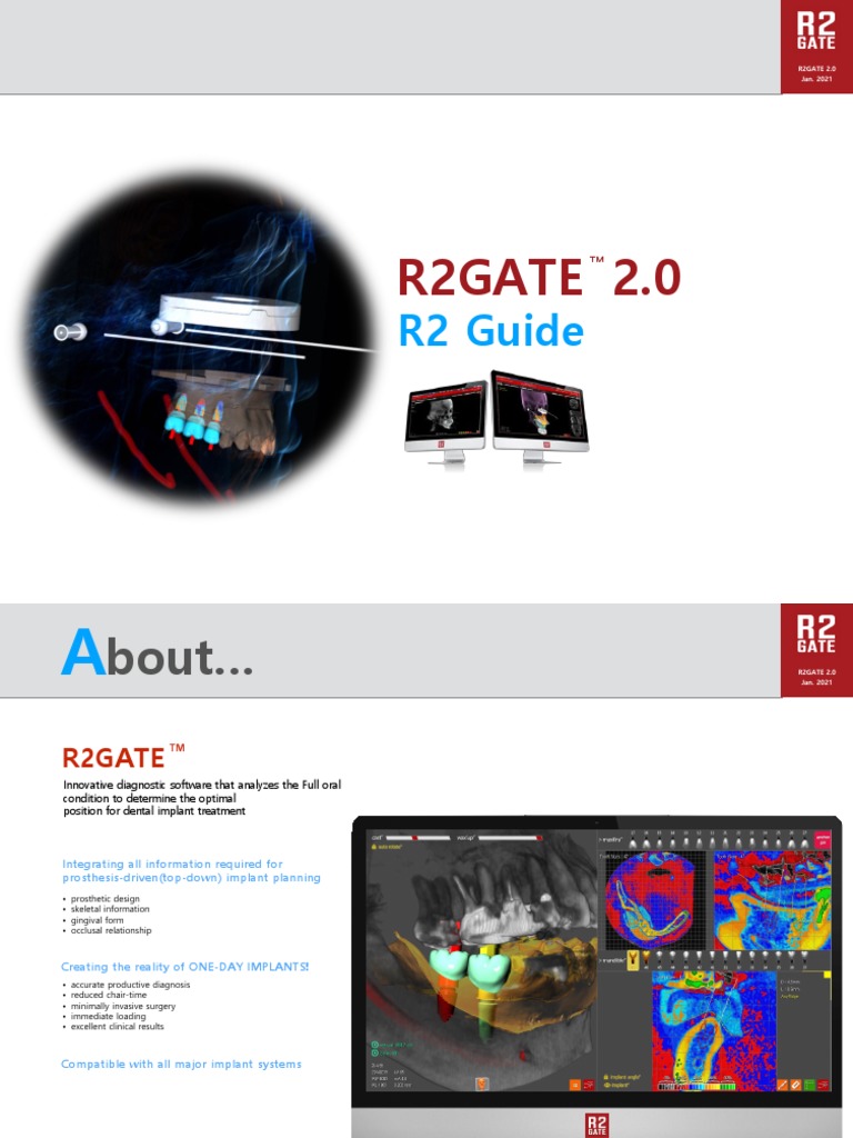 R2GATE 2.0 Manual For Guide (En) - 210208 (Final) | PDF | Dental ...