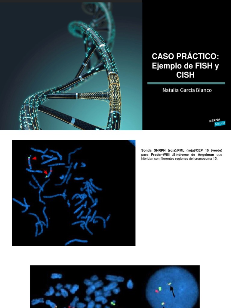 Caso Práctico CISH-FISH | PDF