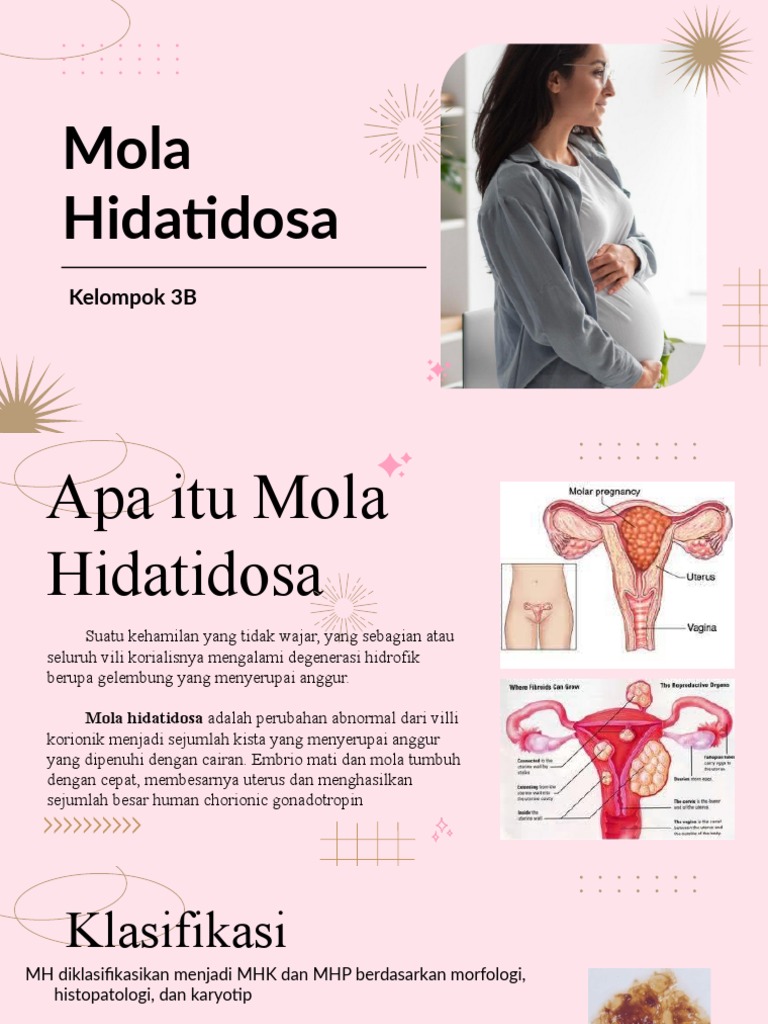Kel 3B Mola Hidatidosa 1 | PDF