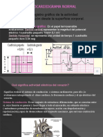 Infradesnivel y Supra del ST en ECG | PDF