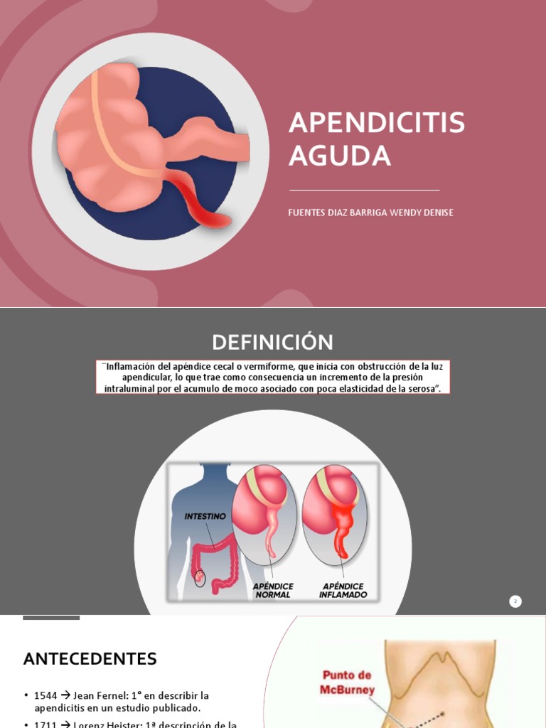 Apendicitis Aguda | PDF