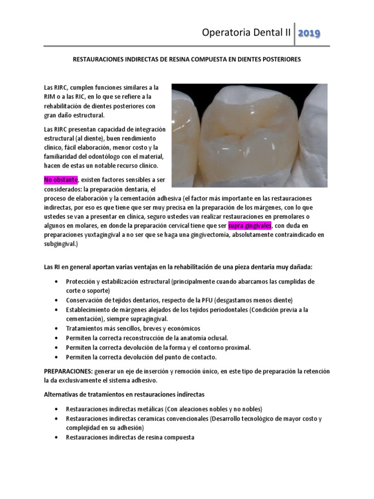 Restauraciones Indirectas de Resina Compuesta en Dientes Posteriores ...