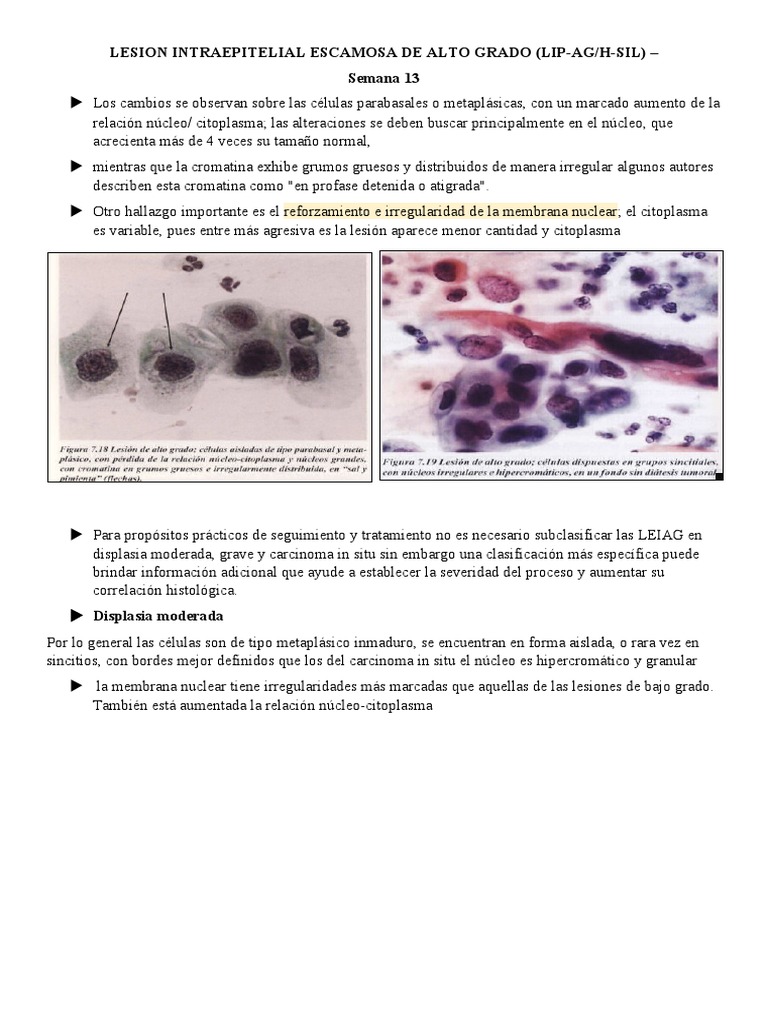 LESION INTRAEPITELIAL ESCAMOSA DE ALTO GRADO Semana 13 | PDF | Biología ...