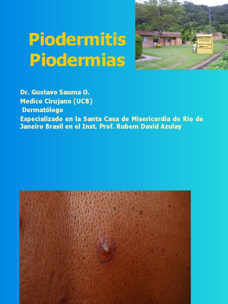 Piodermitis | PDF | Terapia de genes | Infección
