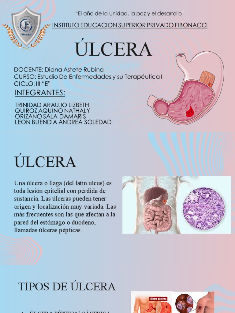 Tipos y Tratamientos de Úlceras | PDF | Herida | Estómago