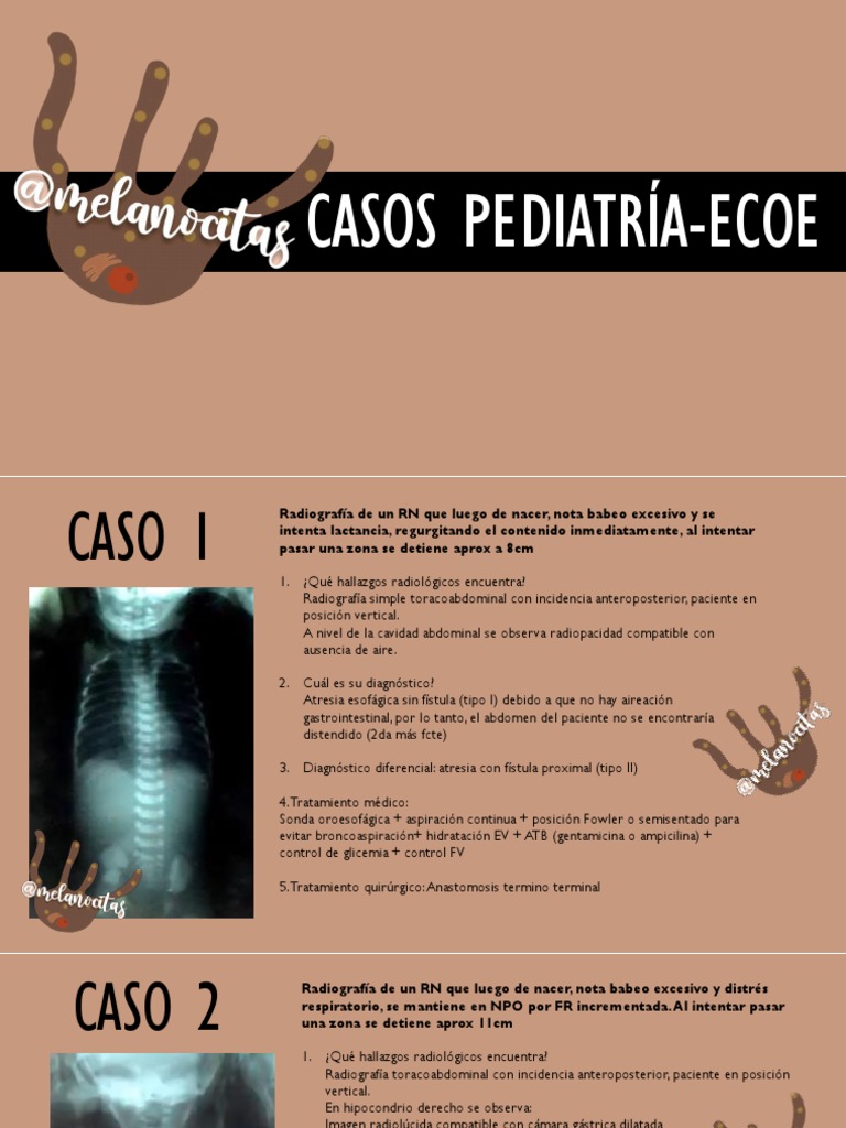 ejemplos de ecoe cirugia pediatrica | PDF | Abdomen | Estómago