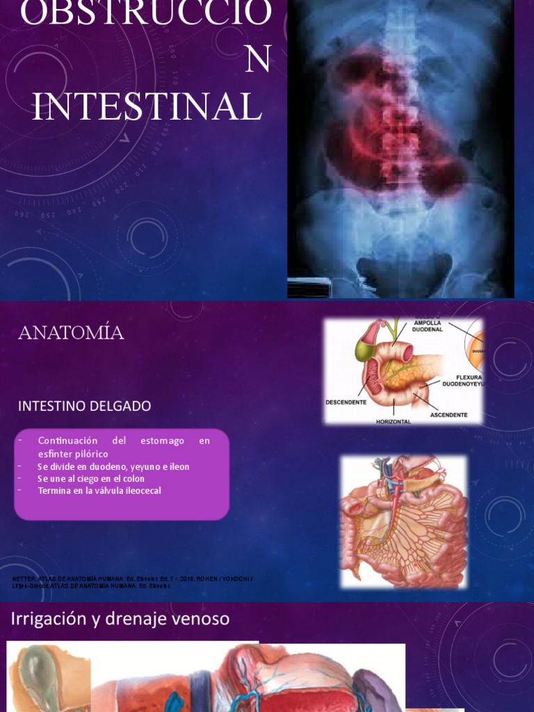 Obstruccion Intestinal | PDF | Intestino grueso | Medicina CLINICA