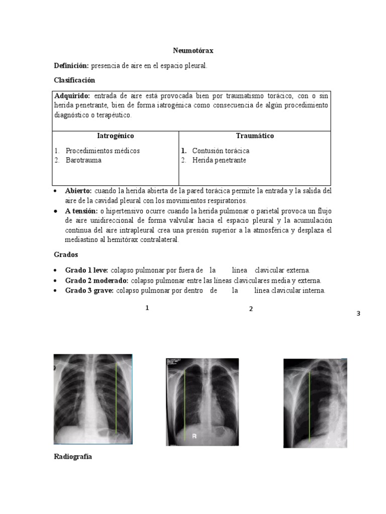 Clasificación y grados de neumotórax | PDF | Neumología | Medicina CLINICA