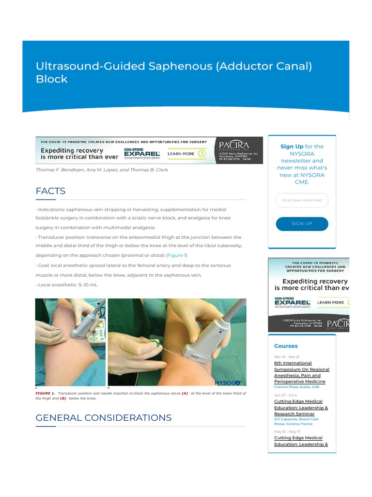 Ultrasound-Guided Saphenous (Adductor Canal) Block - NYSORA | Download ...