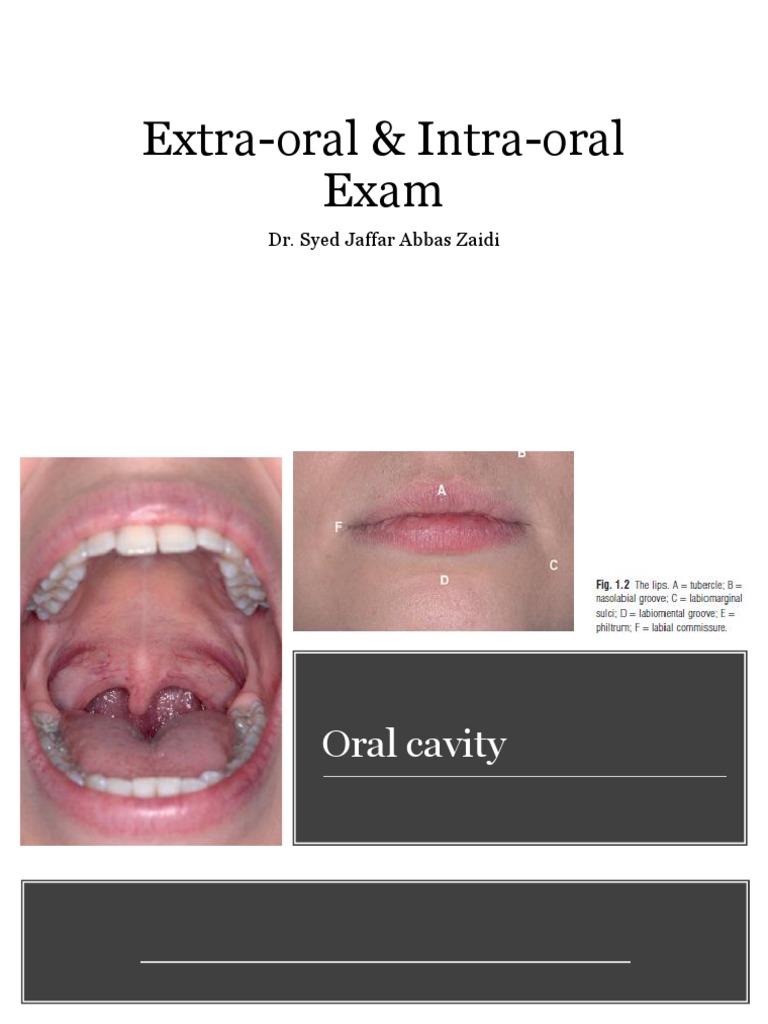 Intraoral & Extraoral Exam Guide | PDF