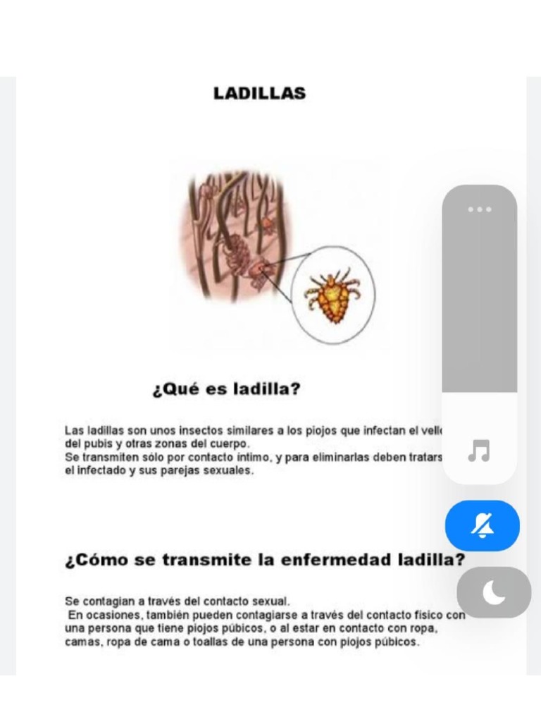 Ladilla | PDF