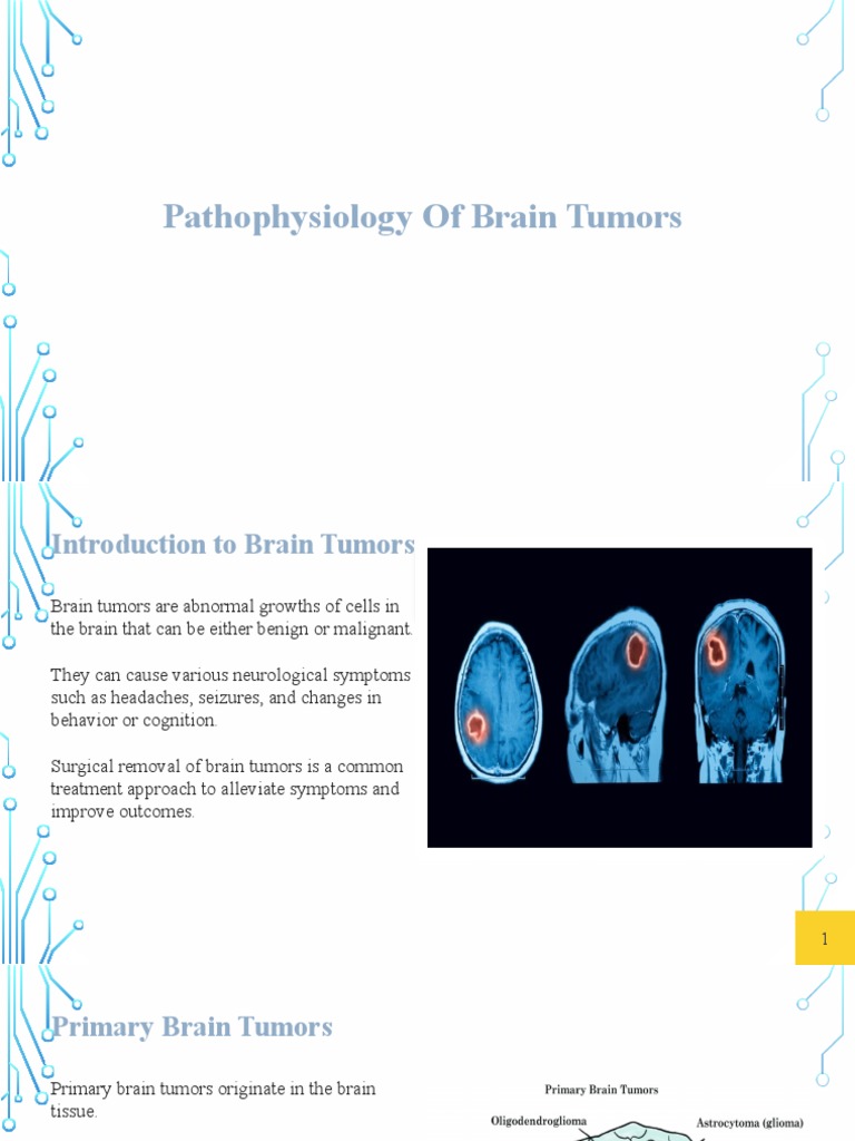 Pathophysiology of Brain Tumors | PDF | Brain Tumor | Angiogenesis