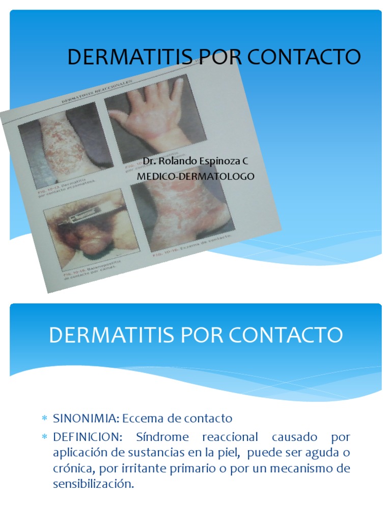 Dermatitis por Contacto: Tipos y Tratamientos | PDF | Sistema inmune ...