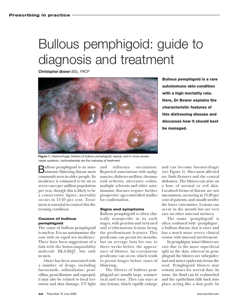 Bullous Pemphigoid Guide To Diagnosis and Treatment - Prescriber - 2010 ...