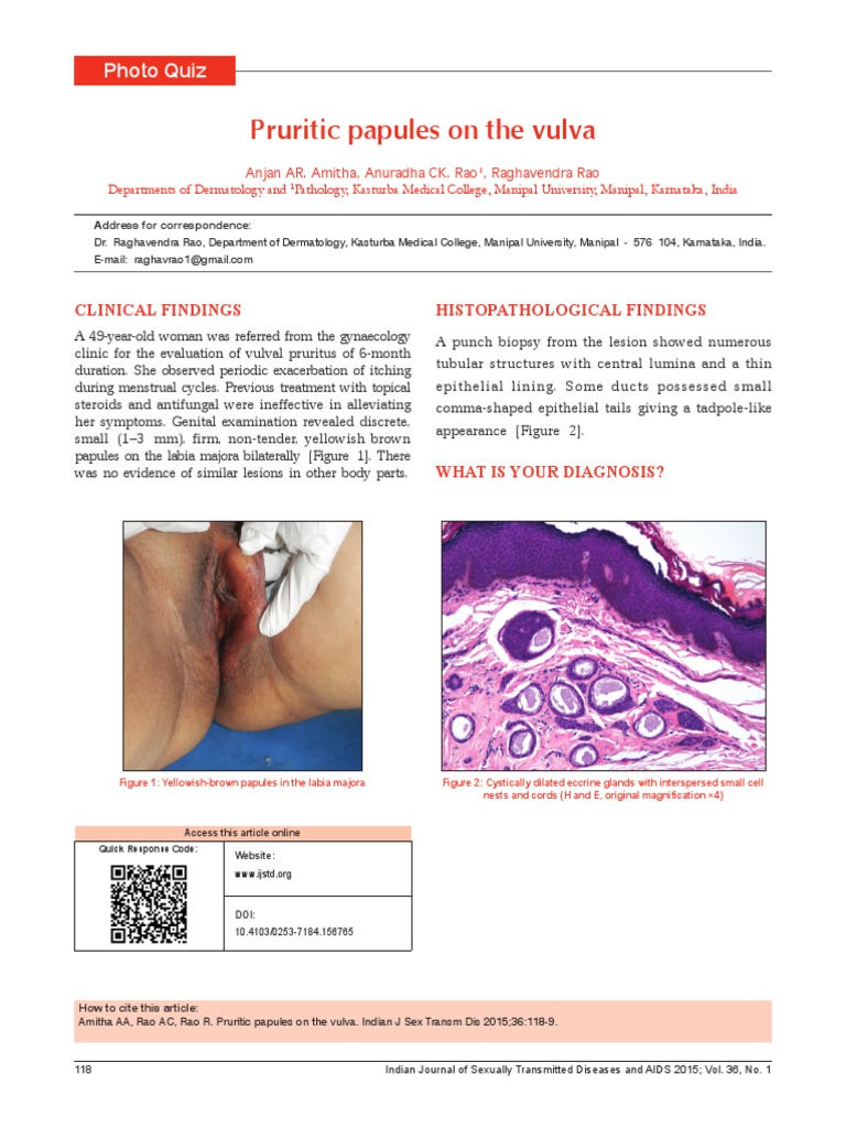 Pruritic Papules On The Vulva | PDF | Epidemiology | Skin