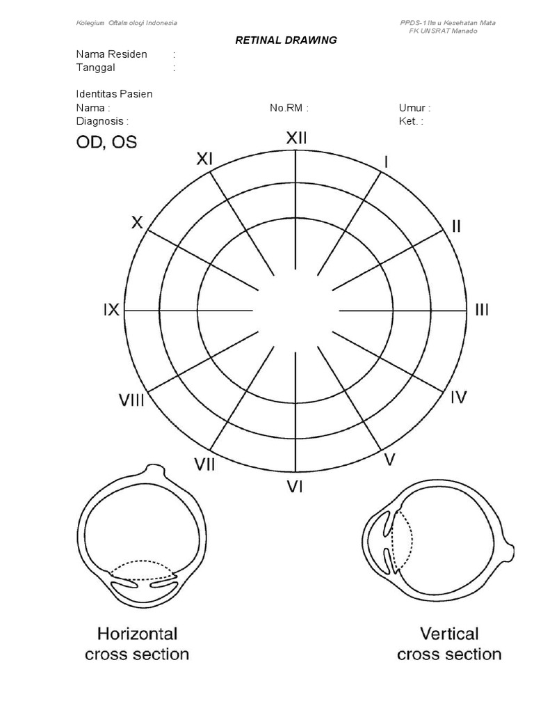 Retinal Drawing | PDF