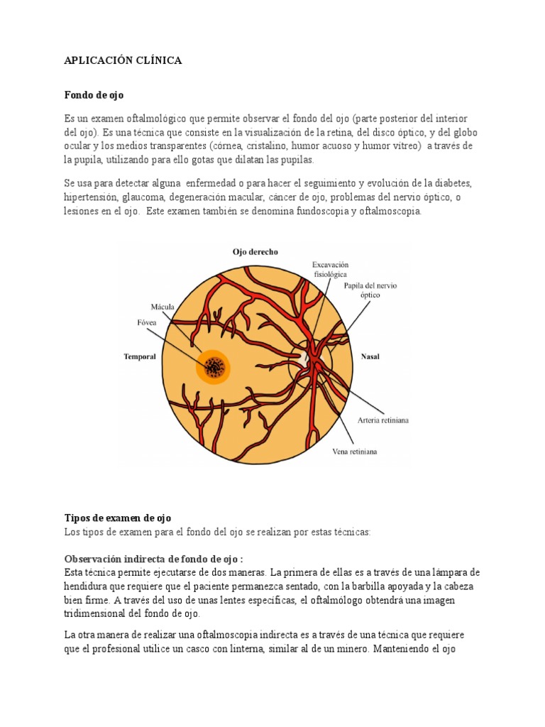 Examen de Fondo de Ojo: Guía Completa | PDF | Ojo humano | Glaucoma