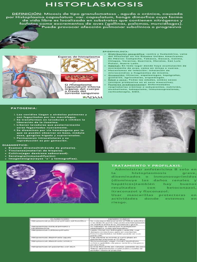 Histoplasmosis Infografia Itzayana Morales Sarmiento | PDF | Medicina CLINICA | Especialidades ...