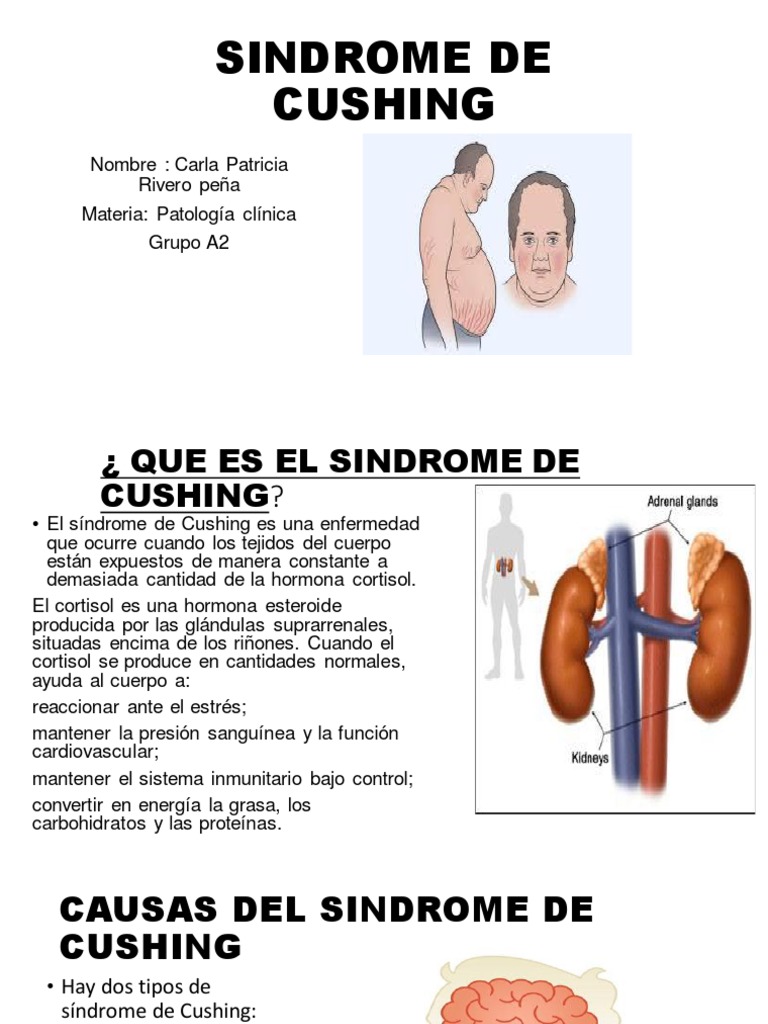 Sindrome de Cushing 25. | PDF | Cortisol | Hormona adrenocorticotrópica