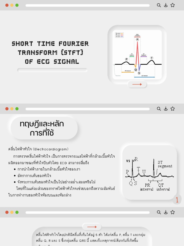 Short Time Fourier Transform (STFT) of ECG Signal | PDF