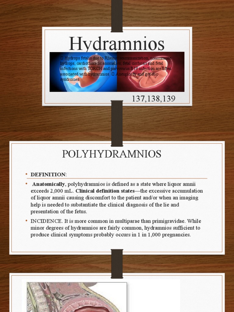 Hydramnios | PDF | Childbirth | Fetus