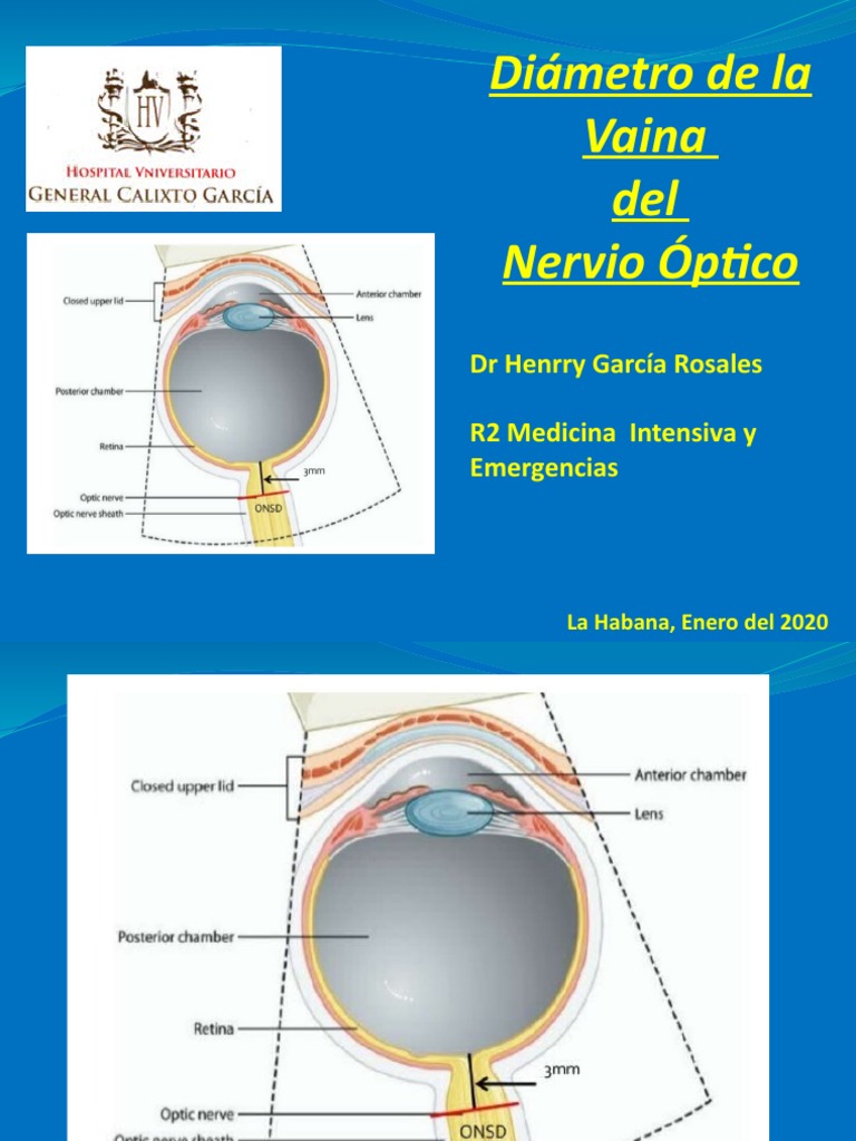 Diámetro de La Vaina Del Nervio Óptico: DR Henrry García Rosales R2 Medicina Intensiva y ...