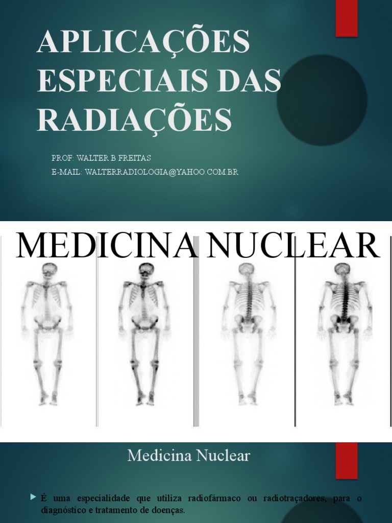 Aplicações da Medicina Nuclear SPECT/CT | PDF | Medicina Nuclear | Raio ...
