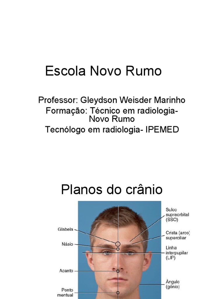 Cranio | PDF | Crânio | Radiologia