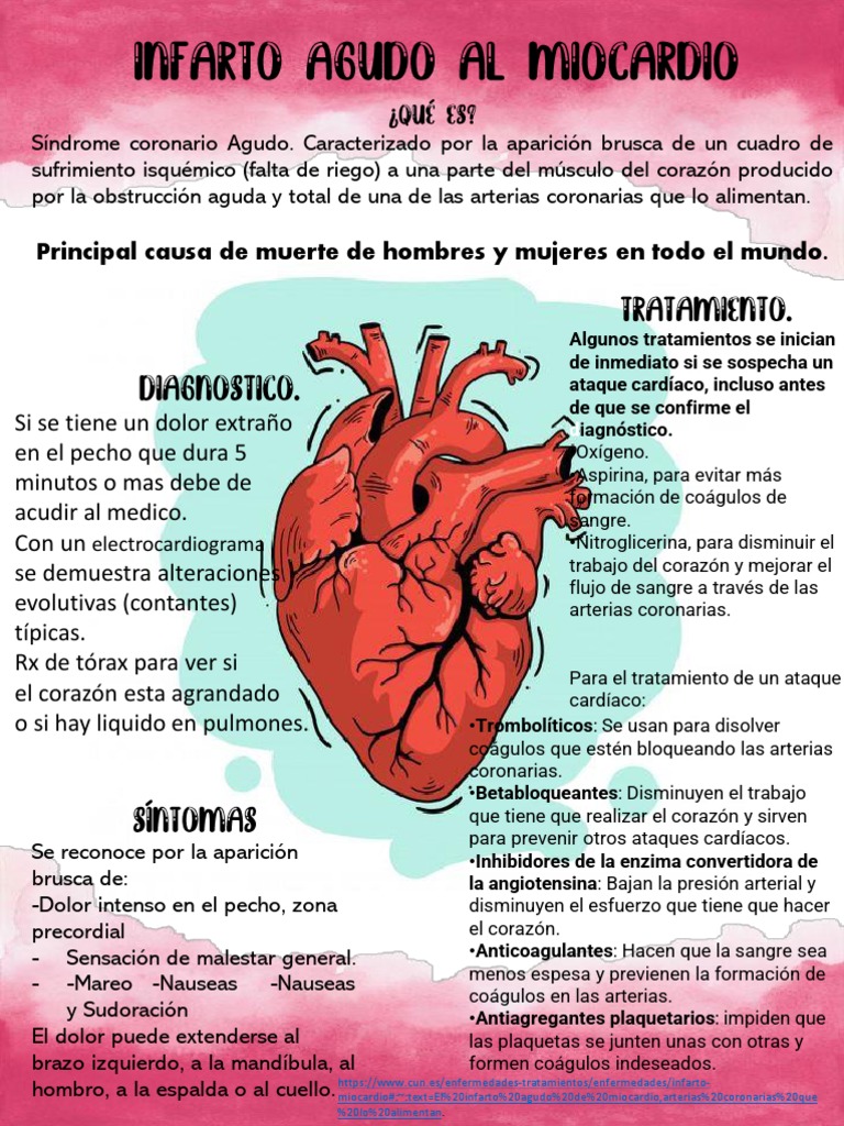 Infarto Agudo al Miocardio | PDF | Infarto de miocardio | Corazón