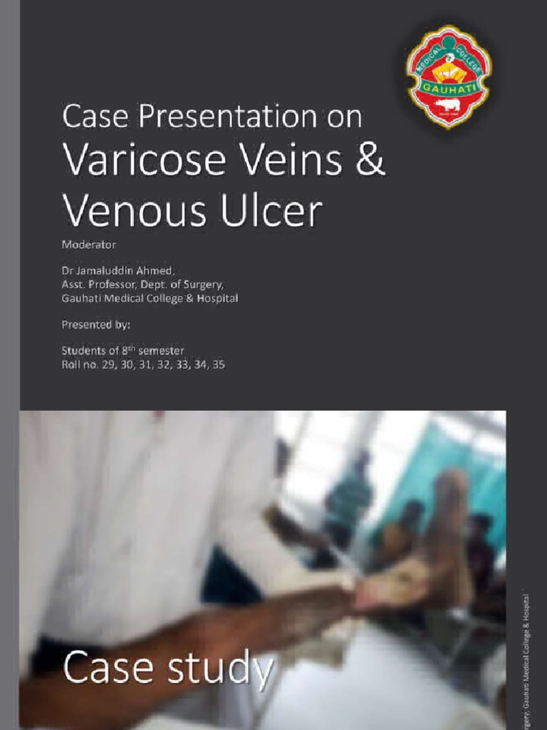 Varicose Veins Case Presentation Pdf