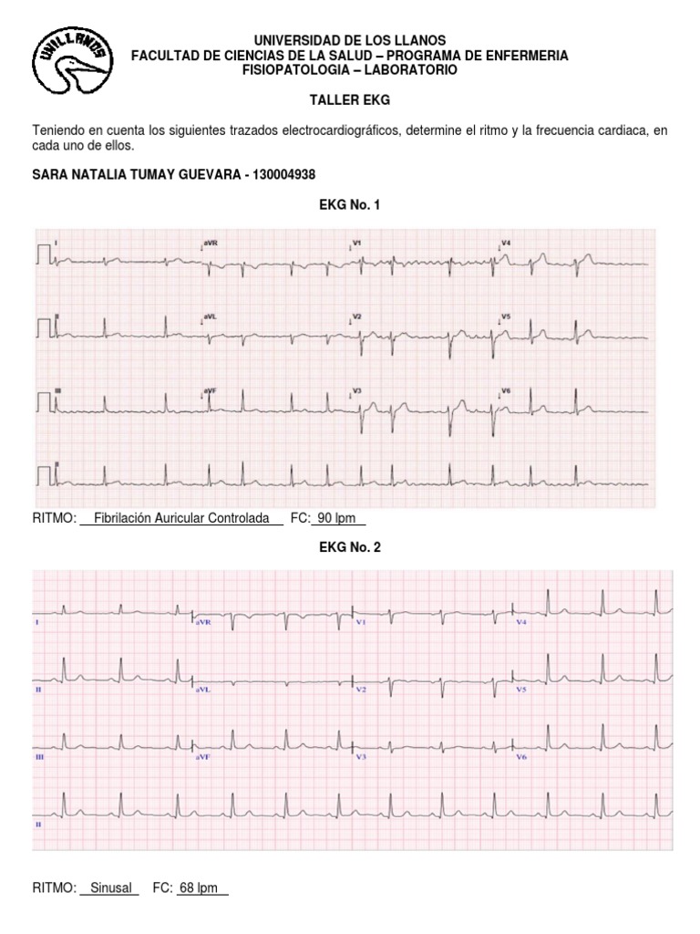 Taller Ekg Nuevo | PDF