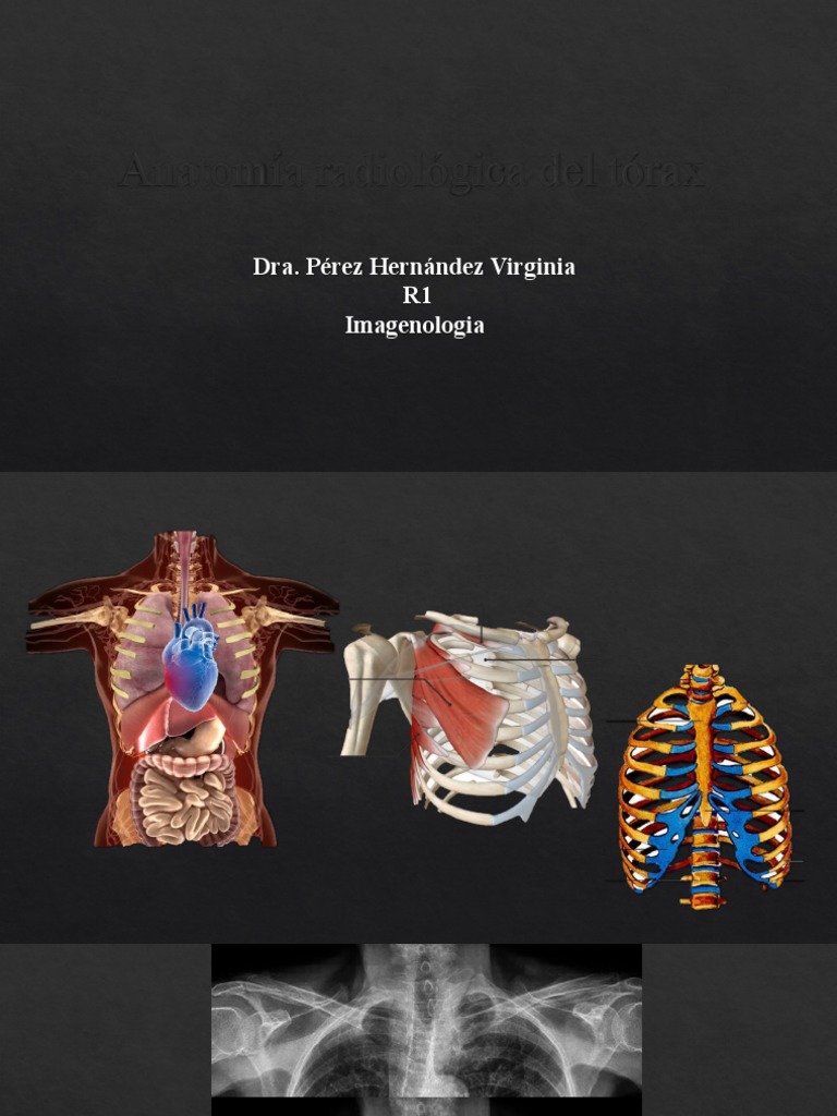 Anatomía Radiológica Del Tórax | Descargar gratis PDF | Tórax ...